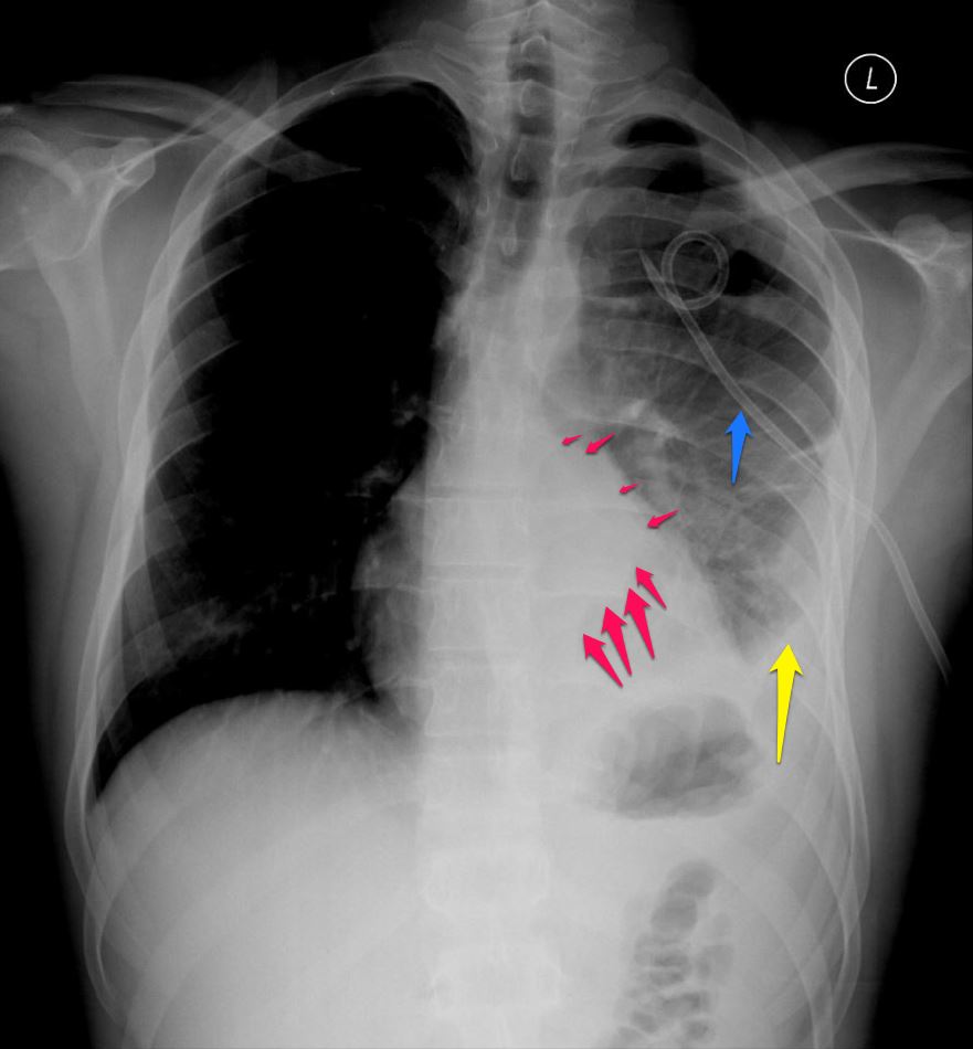 Radiology Cases: Case #3