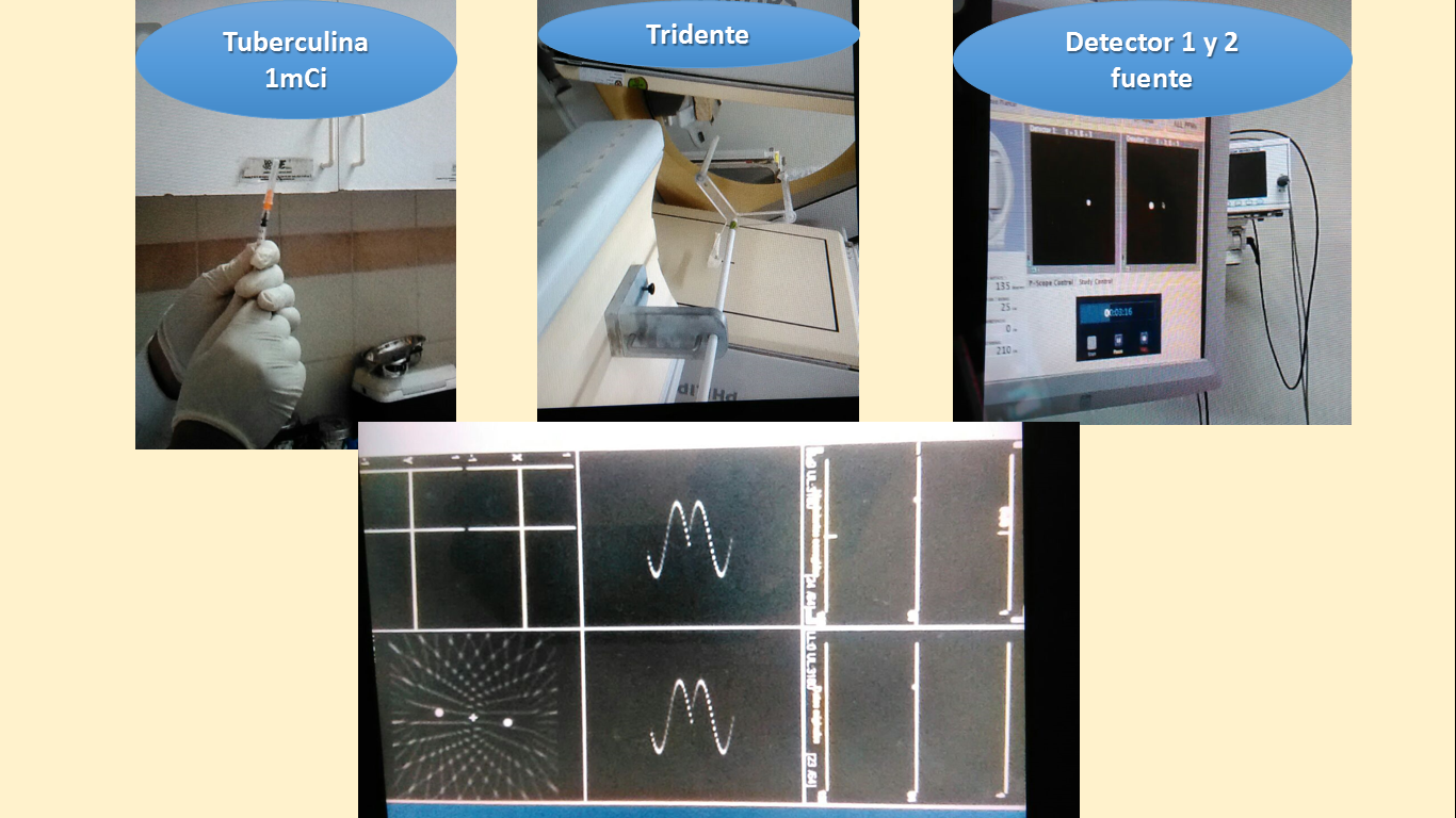 Medicina Nuclear (MN): CONTROL DE CALIDAD EN SISTEMA SPECT