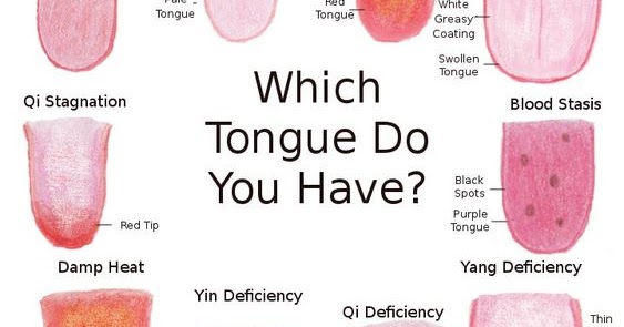 Point on Tongue