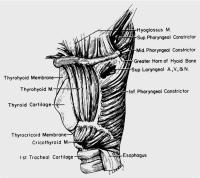 perez new_head neck: 44