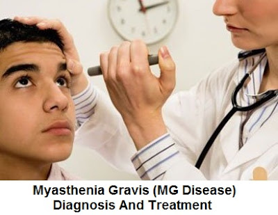 Myasthenia Gravis (Mg Disease): Signs-Symptoms, Diagnosis Inwards ...