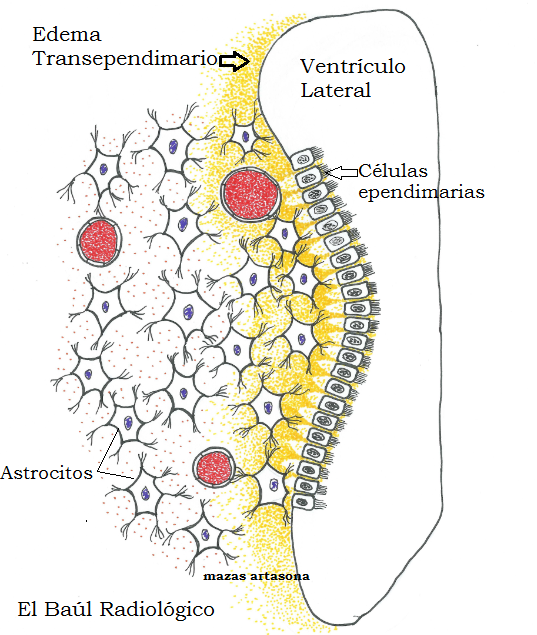 El Baúl Radiológico: abril 2016
