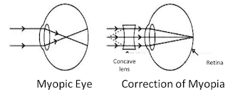 Extra Questions for Class 10th: Ch 11 Human Eye and Colourful World Science