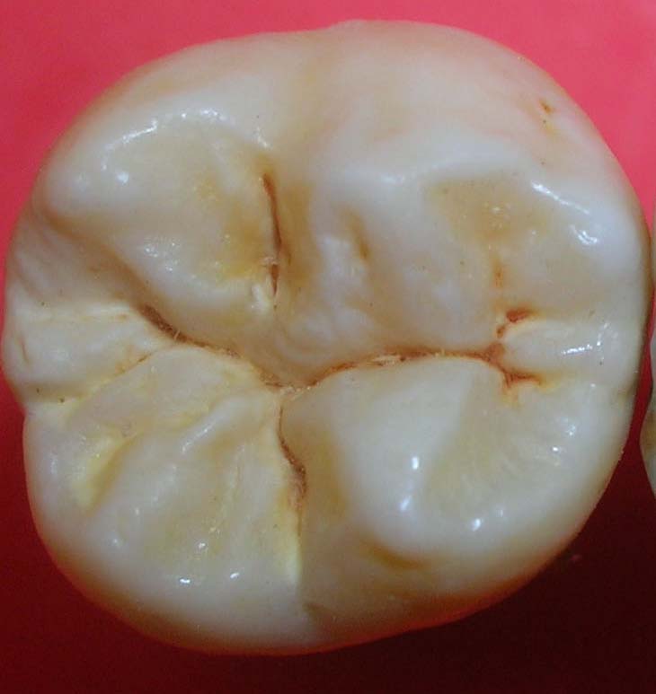 DETALLES ANATOMICOS - Mind42