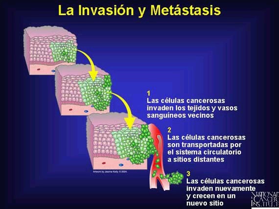 Cancerología de Quintana Roo, A. C. : La invasión y metástasis