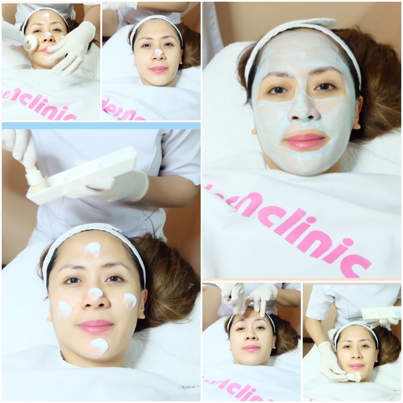 Fight Breakouts with Intense Diamond Peel - Rochelle Rivera