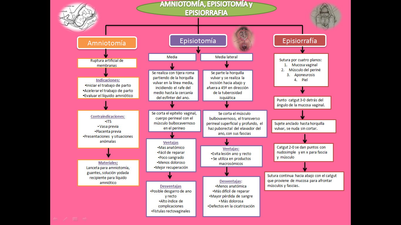 Ginecología y Obstetricia de Villa BLOG: Tarea 19. Amniotomía ...