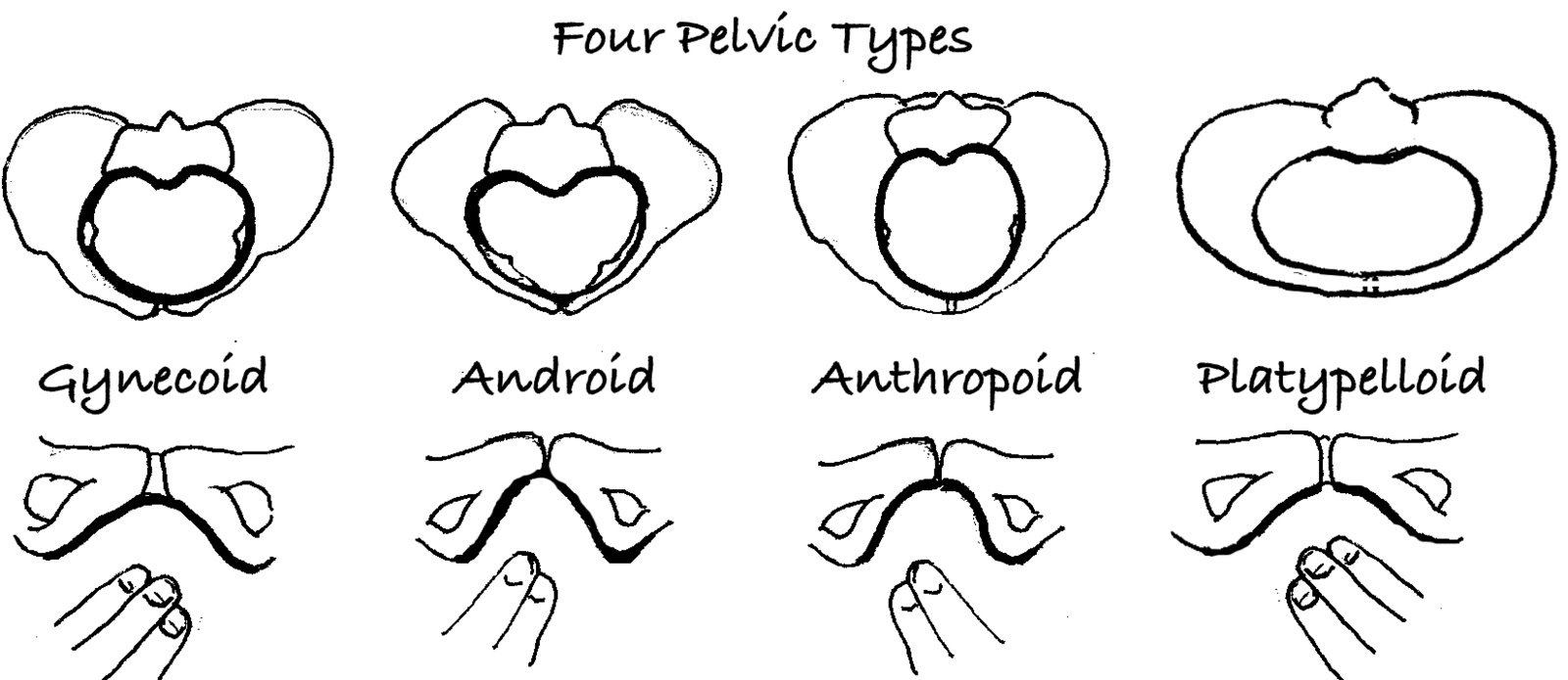 Gynecoid Pelvis Type