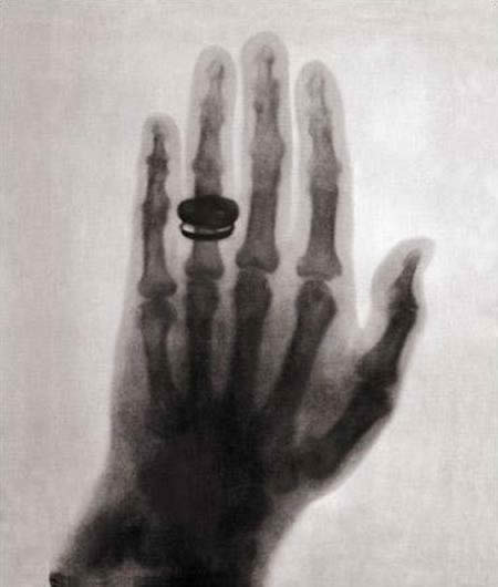 Image for Imagination: World's First X-Ray: Hand mit Ringen (Hand with ...