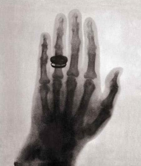 Image for Imagination: World's First X-Ray: Hand mit Ringen (Hand with ...