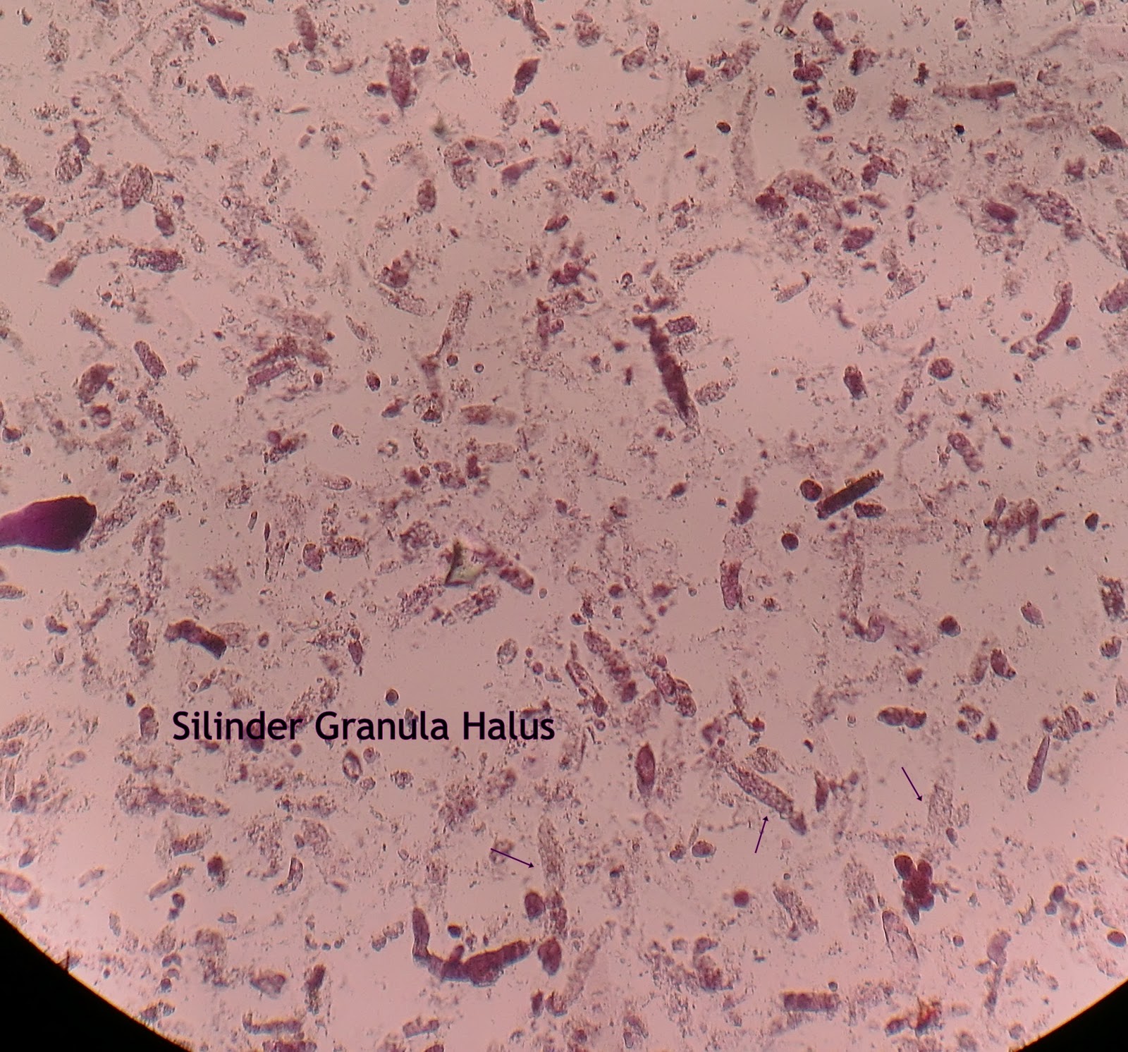 Sedimen Urine Metode Pewarnaan (Stainning) | Analis Kesehatan