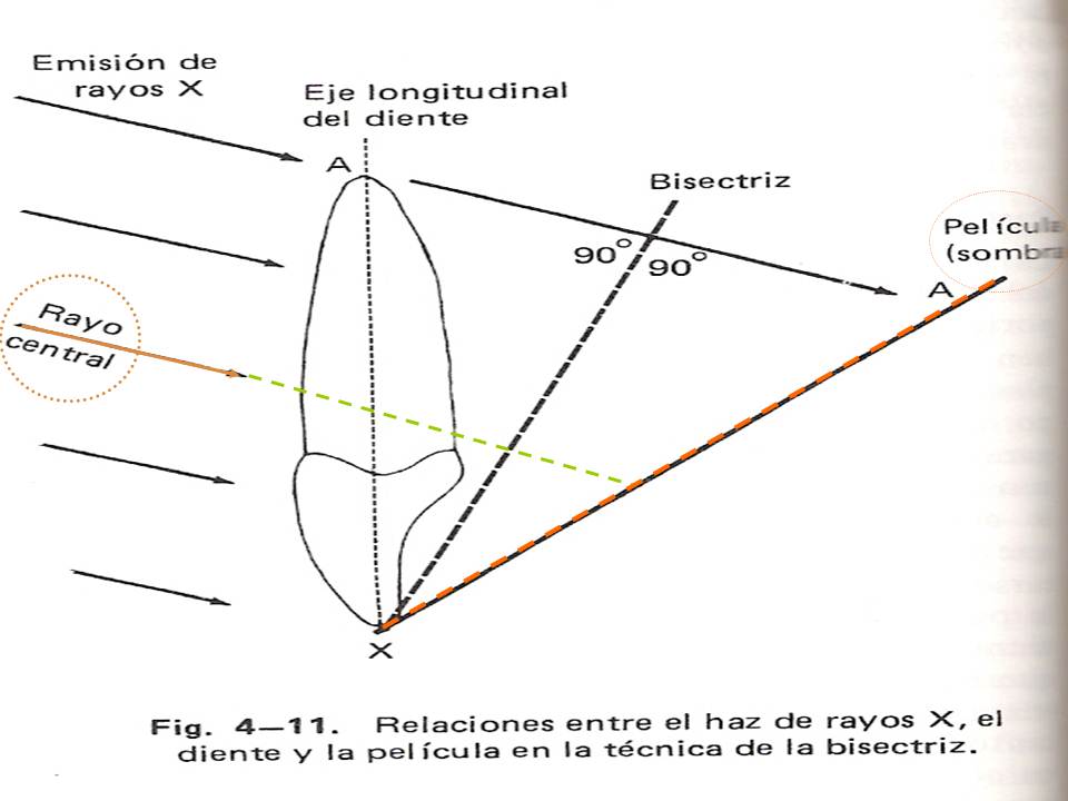 Radiología: TECNICA BISECTRIZ