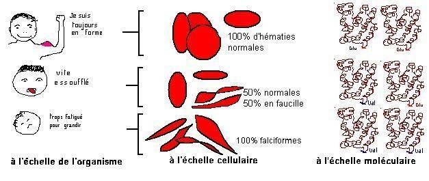 TPE Drépanocytose: La variabilité de la maladie