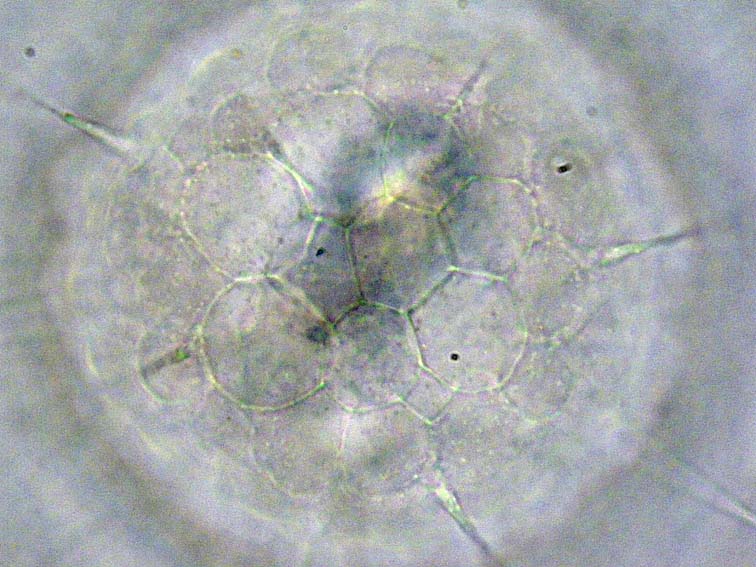 Beyond the Human Eye: Swallowed by the Sun Animacule