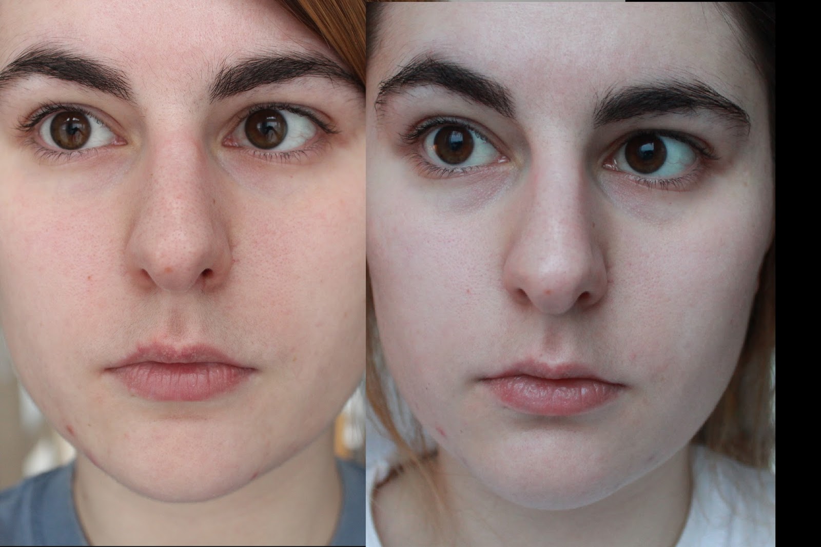 Sleepy Panda: [Review] Mizon All in One Snail Repair Cream