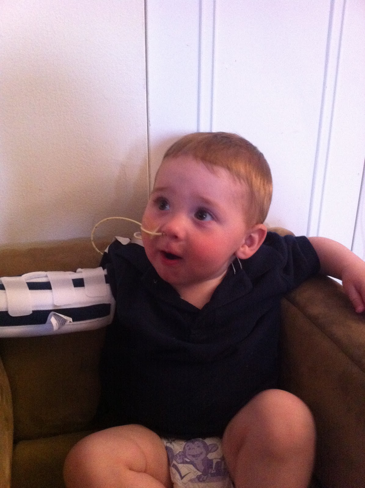 Aidan... With Eos: Feeding Tube: Tube Day