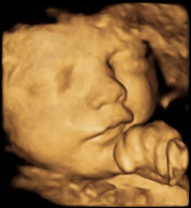 Baby Middle Finger Ultrasound