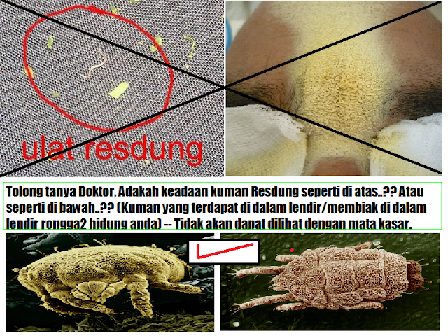RAWATAN RESDUNG PALING MUJARAB (SA0281866-M): RAWATAN RESDUNG ...