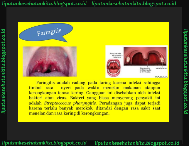 BAHAYA..!! Inilah Jenis Penyakit Sistem & Saluran Pernafasan Yang ...