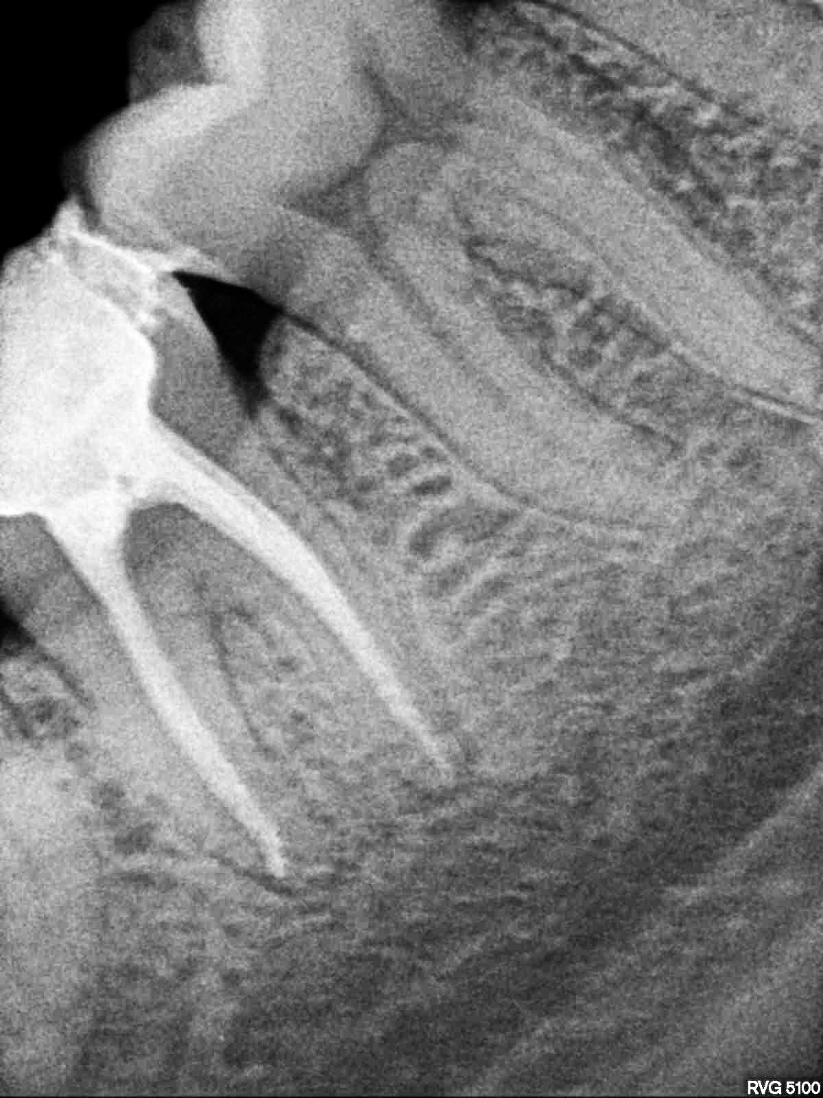 Restorative Dentistry & Endodontics