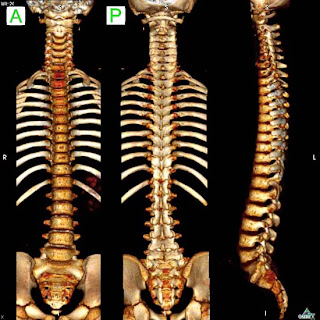 Tomografía Computada y sus alcances