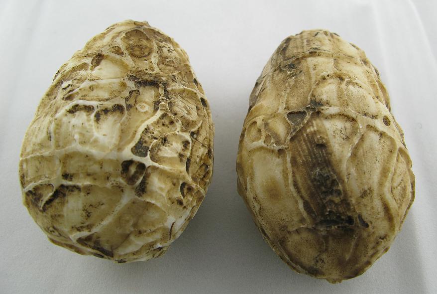 Deformutilation: Bezoar Stones and Mustika Pearls