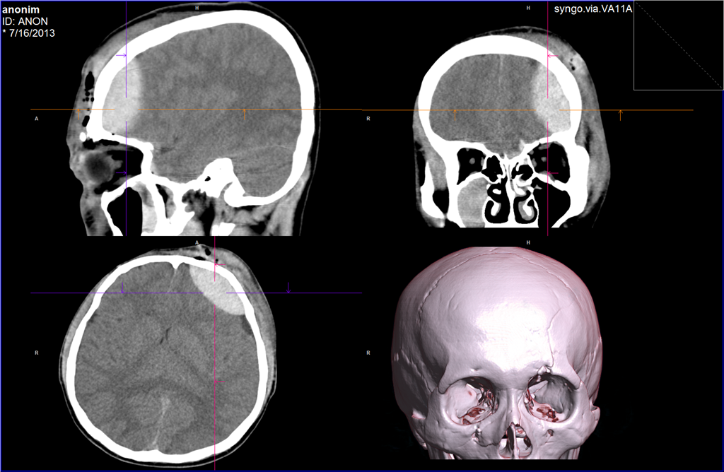 Radiodiagnostik Pemula: CT Scan