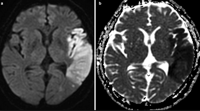 Topo sur L'imagerie de diffusion : bases physiques simplifiées et ...