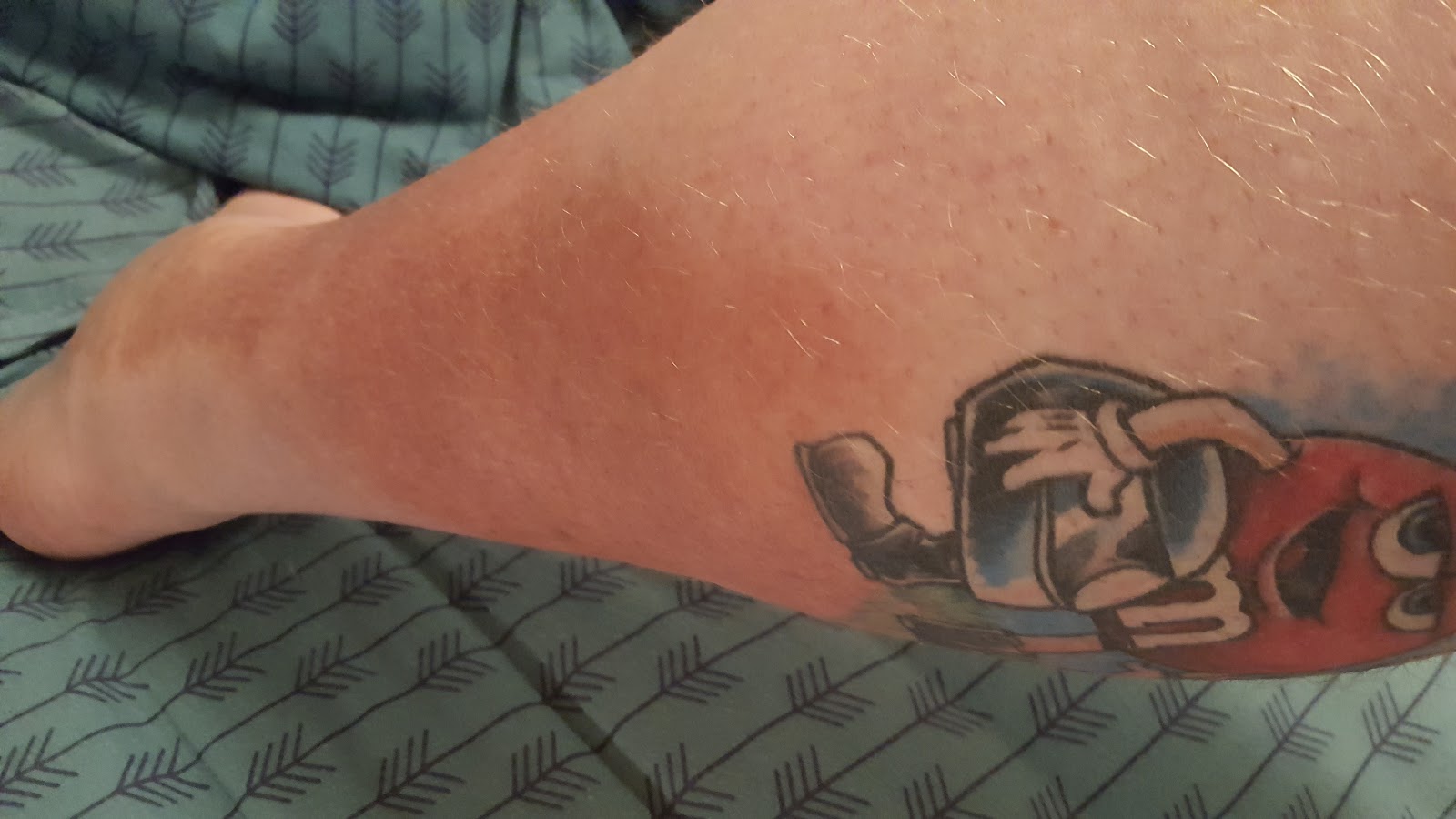 BubbaMike's Ramblings: Cellulitis (warning, graphic photos in this post)