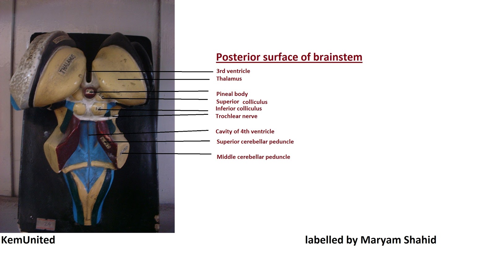Neuroanatomy Models Labelled