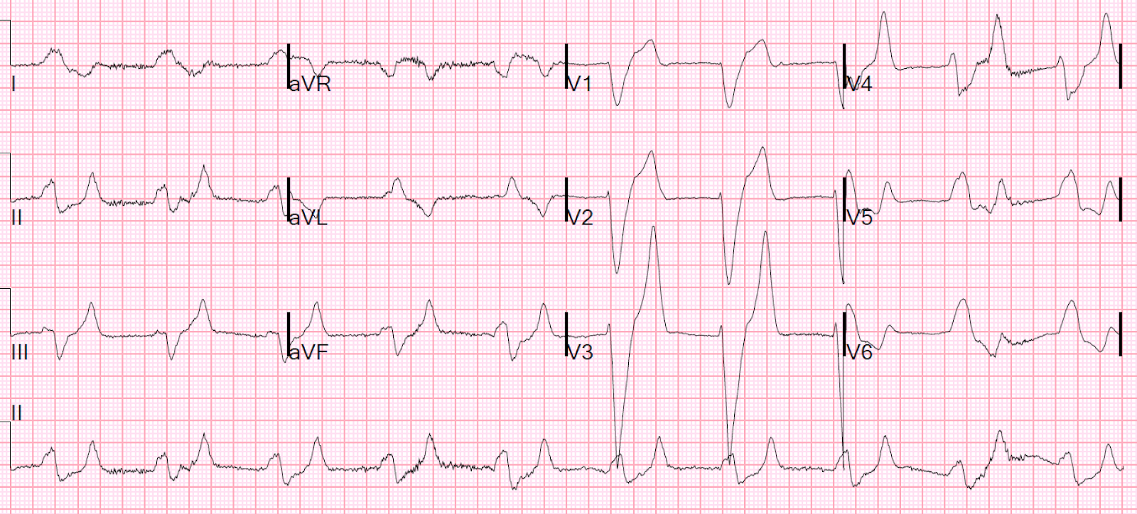 Dr. Smith's ECG Blog