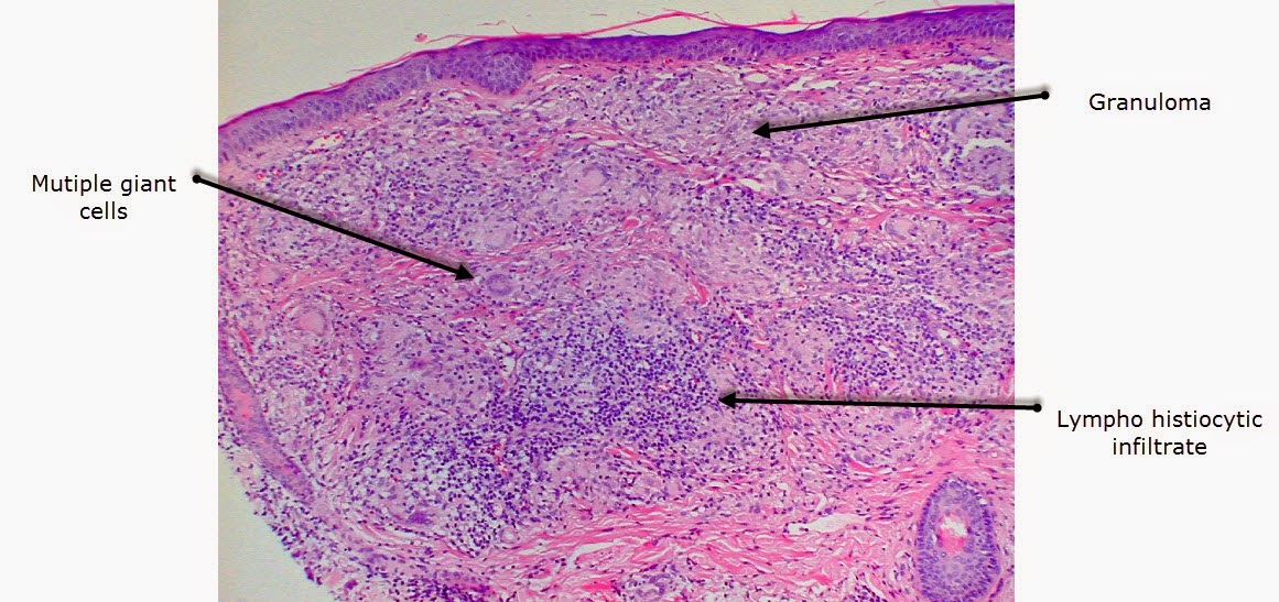 Dermpath Diagnosis: April 2014