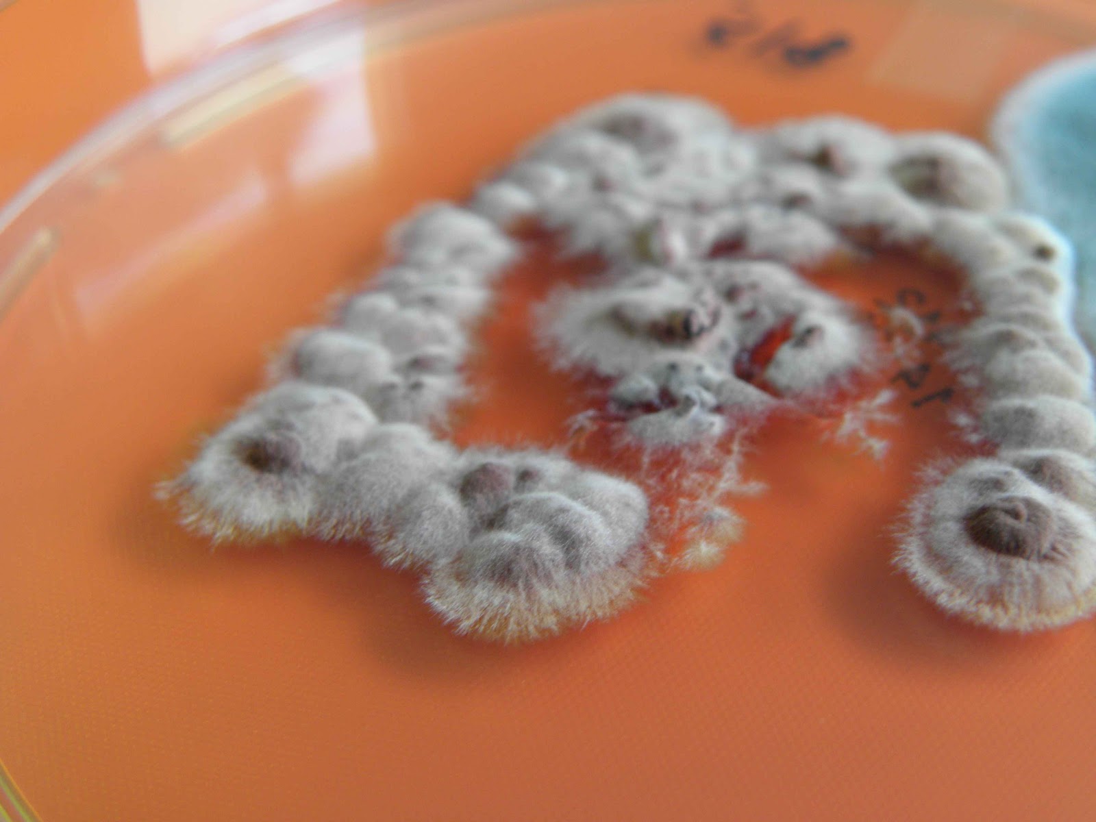 ATLAS MICOLOGIA: TRICHOPHYTON SOUDANENSE