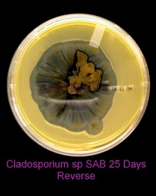 Fun With Microbiology (What's Buggin' You?): Cladosporium species ...