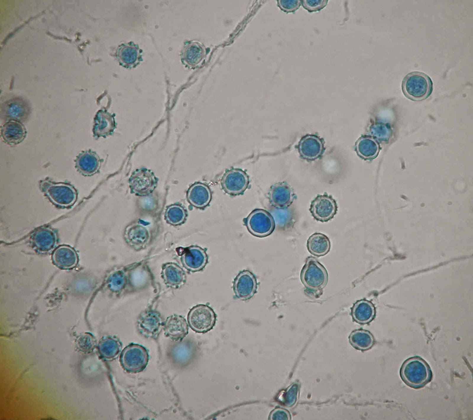 ATLAS MICOLOGIA: CONIDIOBOLUS CORONATUS