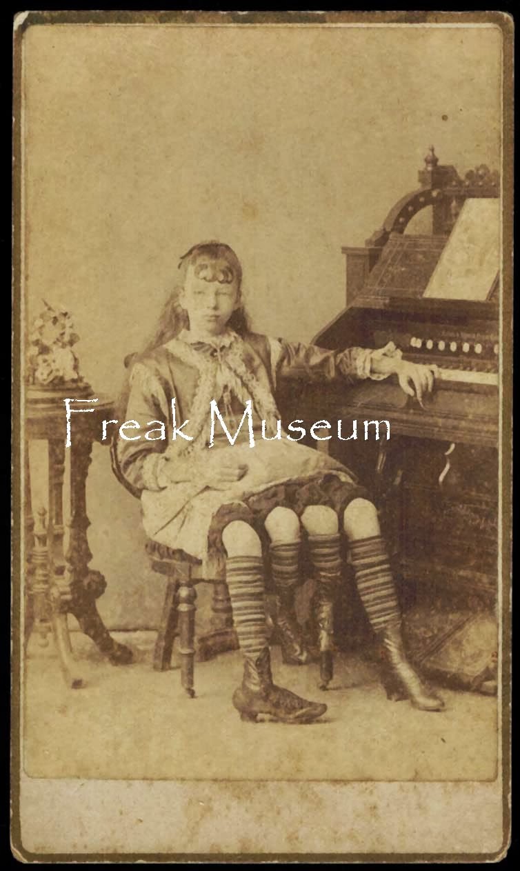 Freak Museum A Private Collection: Freak Photos 19th c.