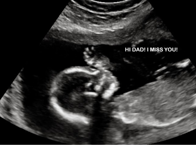 All My Favorites: 19 weeks - Ultrasound #4