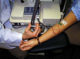 Fundus Camera and Retinal Angiography: Fluorescein pathway and timing