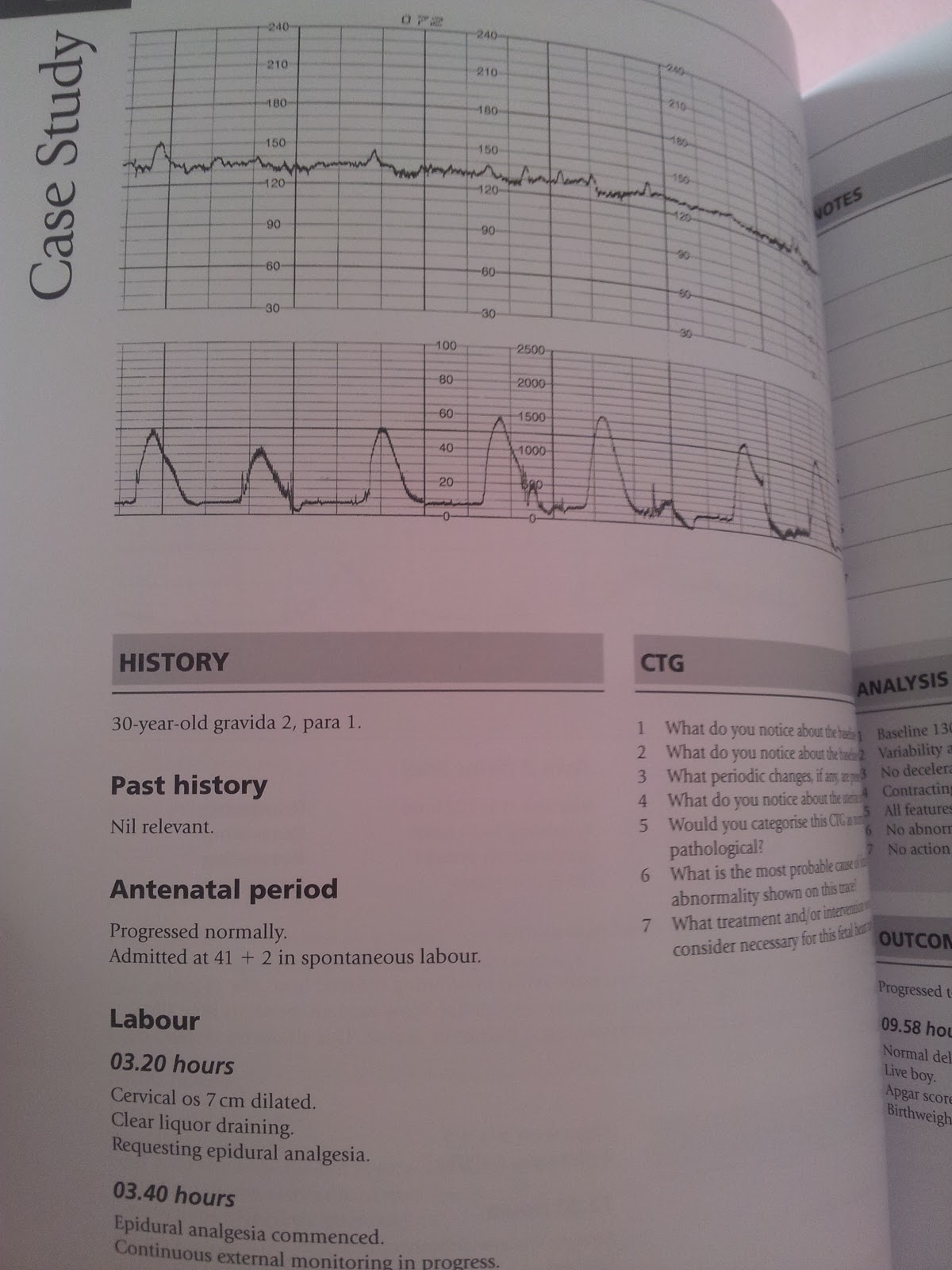 Bukumedik Blogspot (Medical Books Online Shoppe): CTG Made Easy, 4th ...