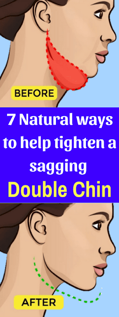 7 Natural Ways To Help Tighten A Sagging Double Chin