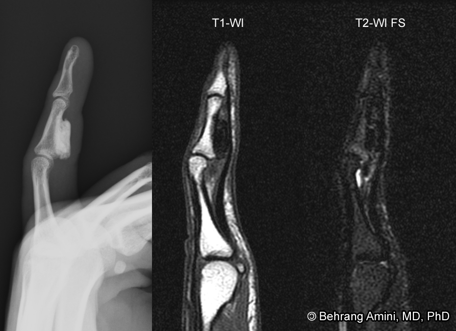 Roentgen Ray Reader: September 2009