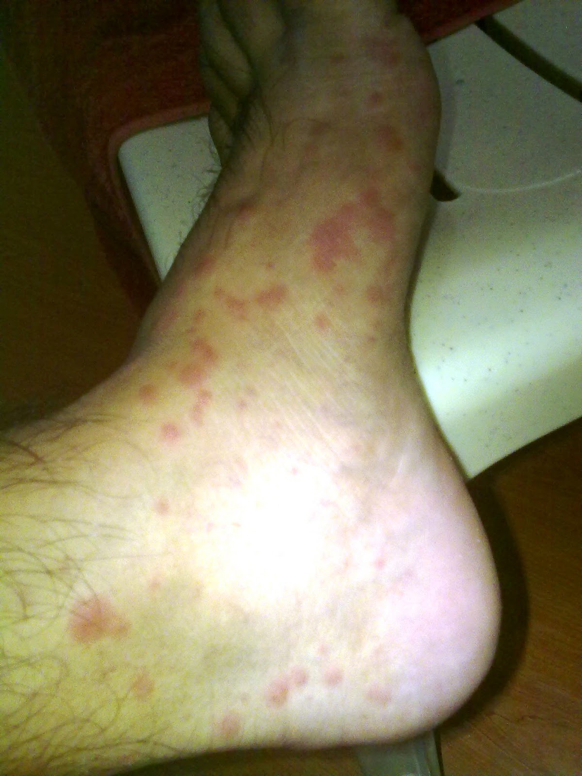 The JAKE POSITIVE BLOG: 2ND WEEK AND 3RD WEEK OF ARV TRIAL