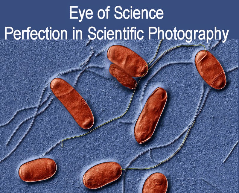Medical Laboratory and Biomedical Science: Eye of Science - Perfection ...