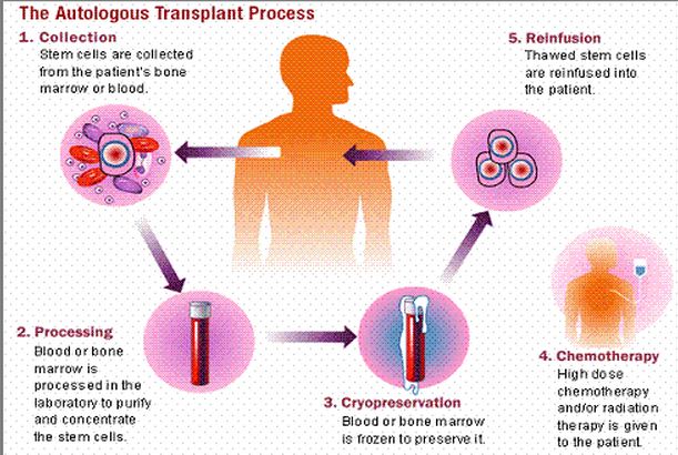 Autologous |Genetic Engineering Info