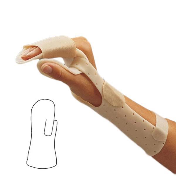 Terapia Ocupacional: Guía para la realización de férulas - PLANTILLAS