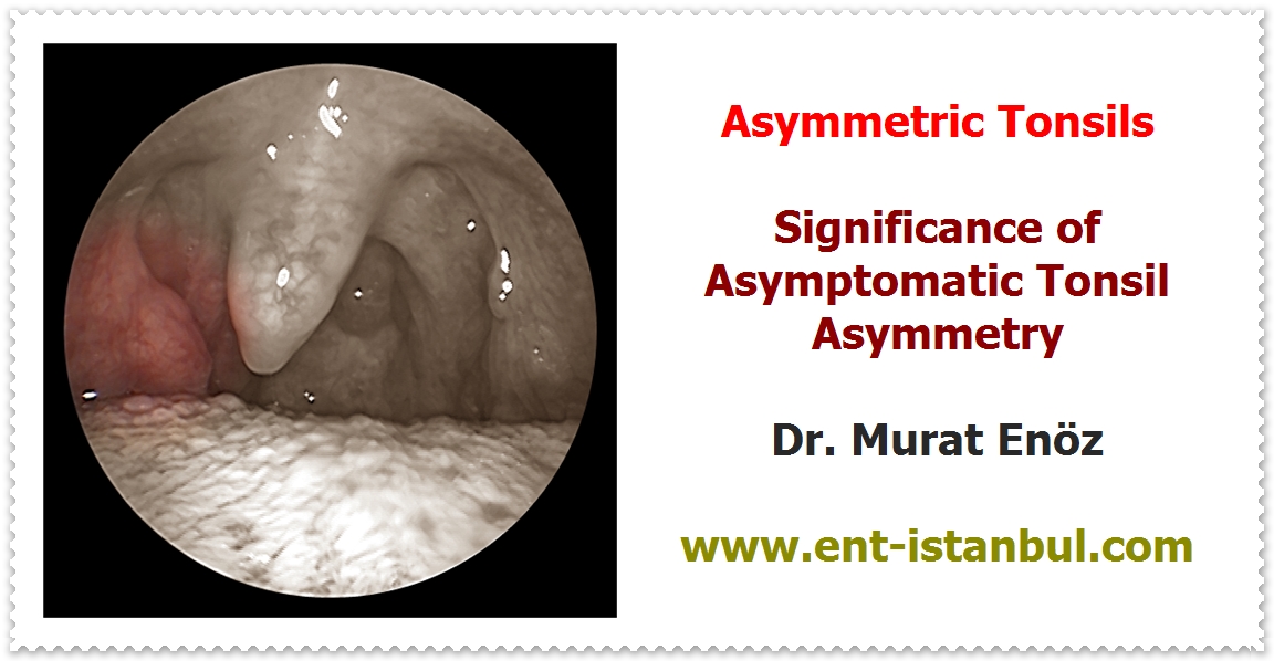 Tonsils and Adenoids