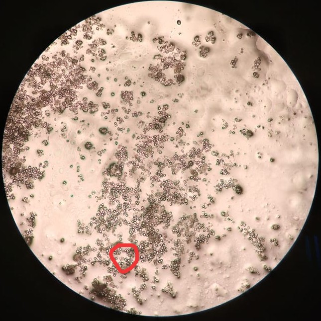 BENDA ERGASTIK ALEURON PADA TUMBUHAN