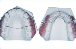 APARATOLOGIA ORTOPEDICA: FRANKEL IB
