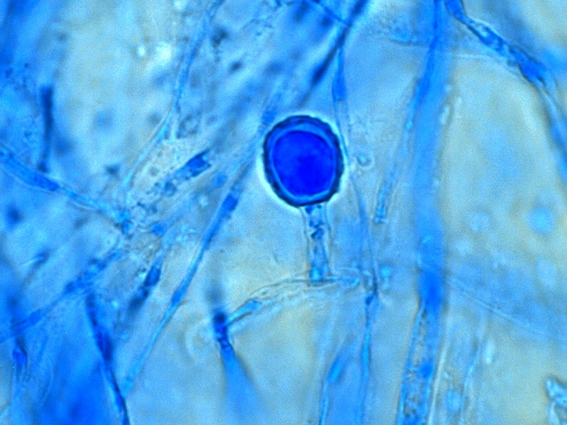 Fun With Microbiology (What's Buggin' You?): Sepedonium species
