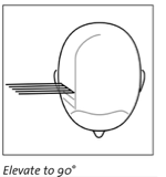 Diagonal short layer